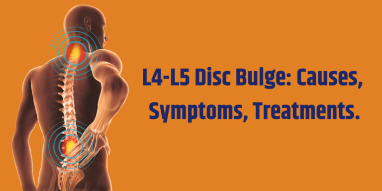 L4-L5 Disc Bulge: Causes, Symptoms, Treatments.